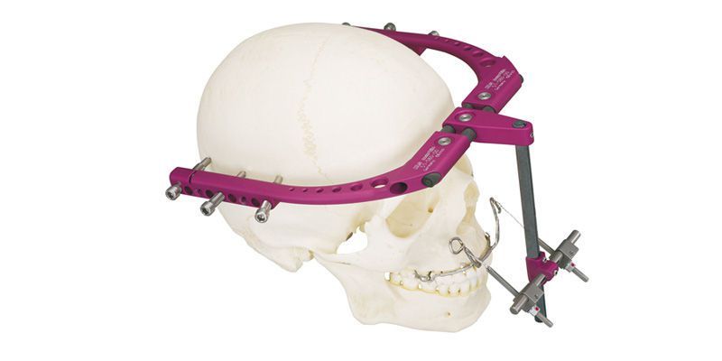 Health Management and Leadership Portal | Electrosurgical unit smoke ...