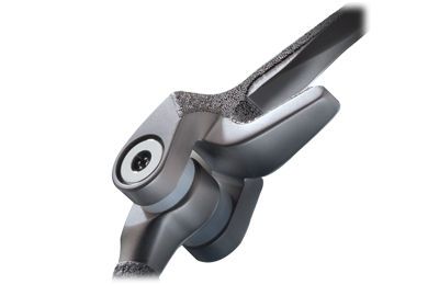 Health Management and Leadership Portal | Total elbow prosthesis ...