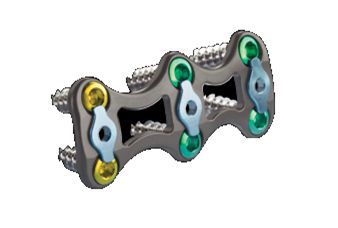 Health Management and Leadership Portal | Cervical arthrodesis plate ...