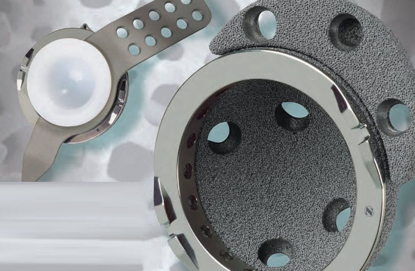 Health Management and Leadership Portal | Revision acetabular ...