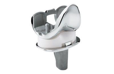 Health Management and Leadership Portal | Three-compartment knee ...