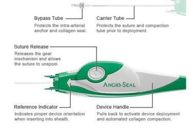 Health Management and Leadership Portal | Vascular closure system Angio ...