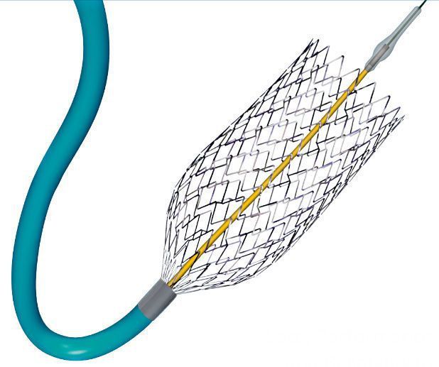 Health Management and Leadership Portal | Embolic protection system ...