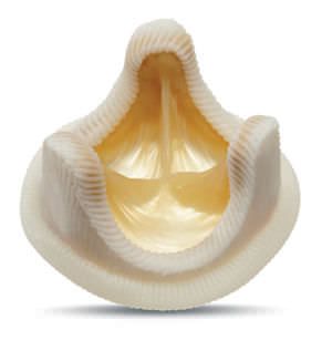 Health Management and Leadership Portal | Aortic valve bioprosthesis ...