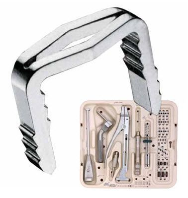 Health Management and Leadership Portal | Tarsal bones bone staple ...