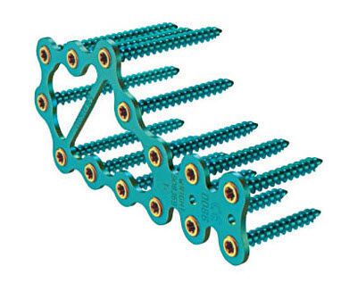 Health Management and Leadership Portal | Ulna osteotomy plate RAYHACK ...