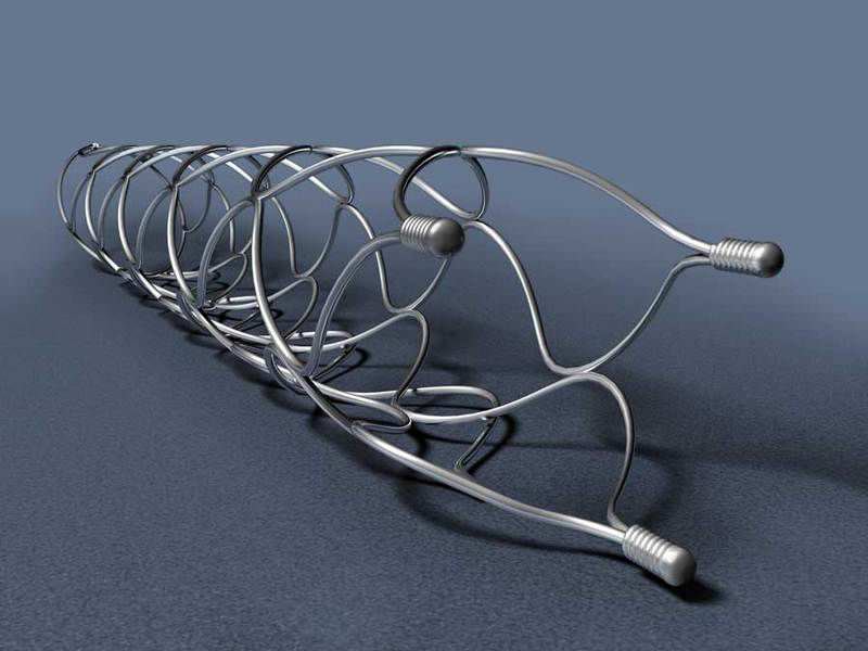 Health Management and Leadership Portal | Stent / embolization coil ...