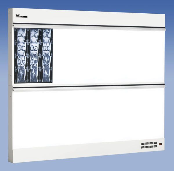 Health Management and Leadership Portal | White light X-ray film viewer ...