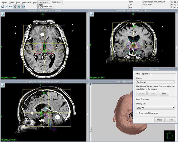 Health Management and Leadership Portal | Stereotactic frame Leksell ...