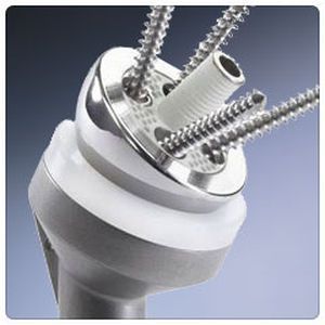 Health Management and Leadership Portal | Inverted total shoulder ...