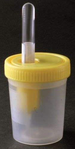 Health Management and Leadership Portal | Urine sample container BSC200 ...