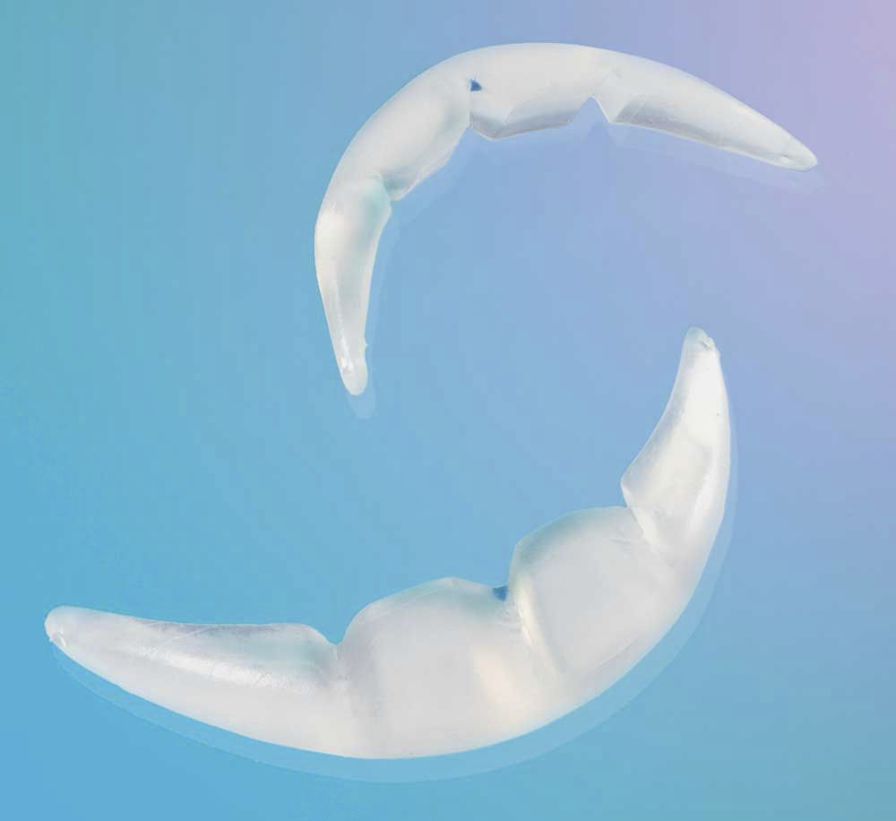 Health Management and Leadership Portal | Chin cosmetic implant ...