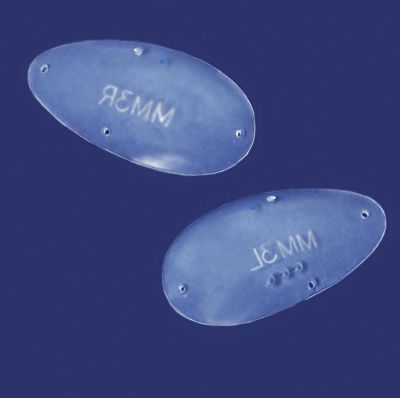 Health Management and Leadership Portal | Chin cosmetic implant ...