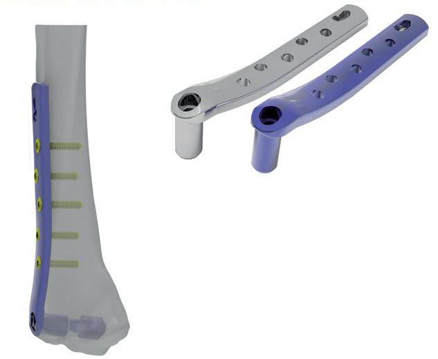 Health Management and Leadership Portal | Femoral head compression bone ...