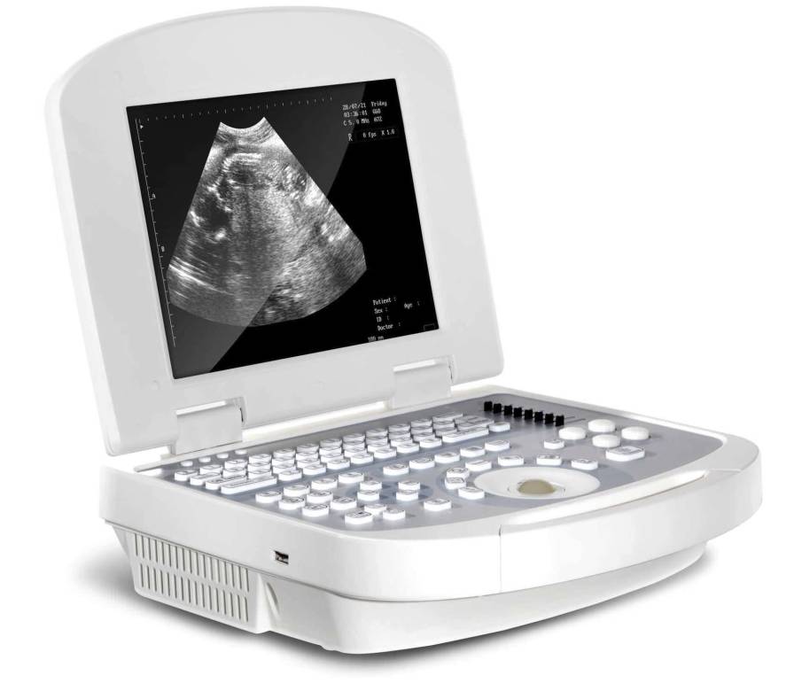 Health Management and Leadership Portal | Portable ultrasound system ...