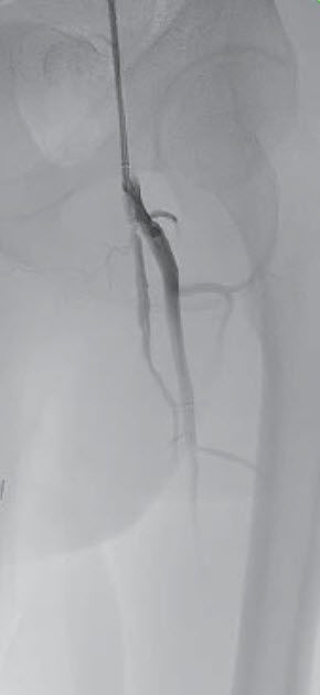 Health Management and Leadership Portal | Surgical laser / for ...