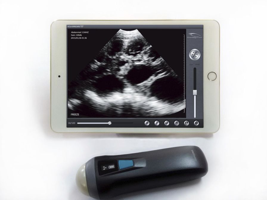 Health Management and Leadership Portal | Portable ultrasound system ...