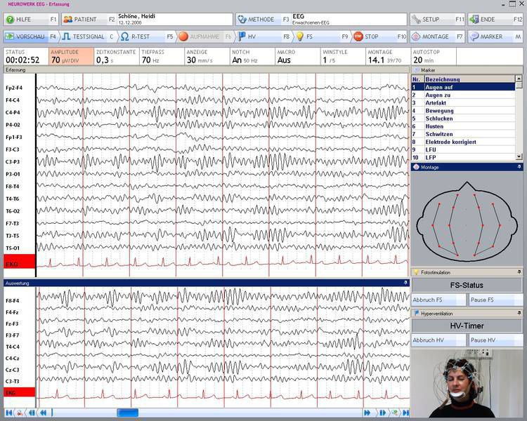 Health Management and Leadership Portal | Digital electromyograph ...