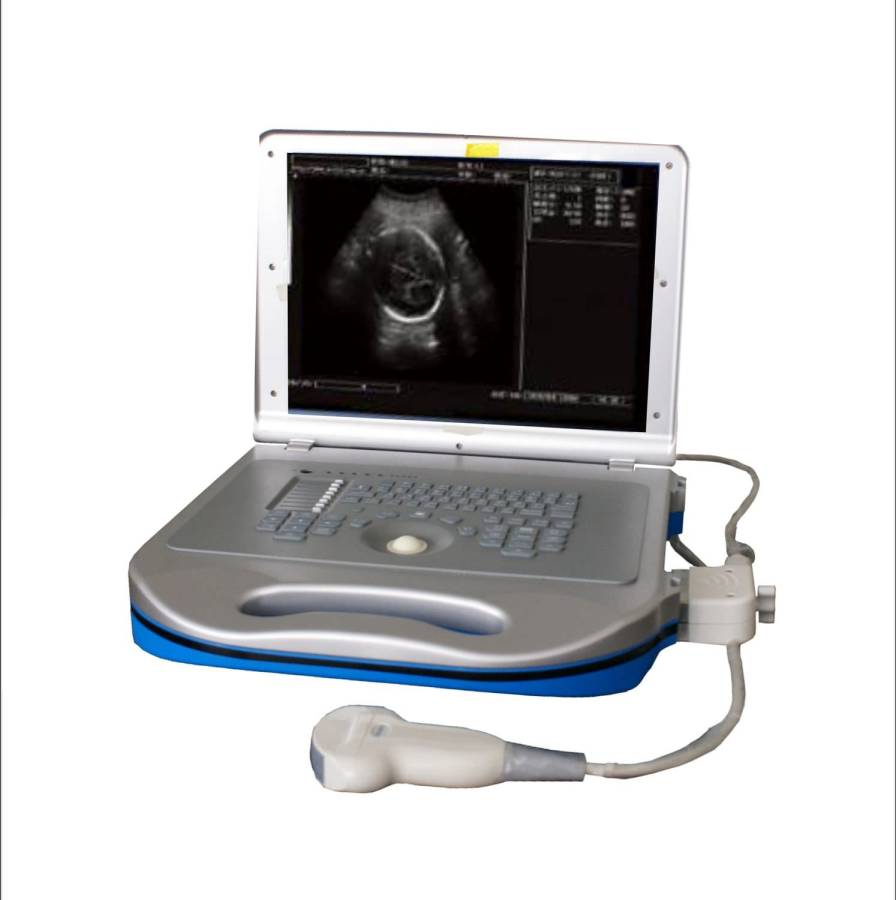 Health Management and Leadership Portal | Portable ultrasound system ...