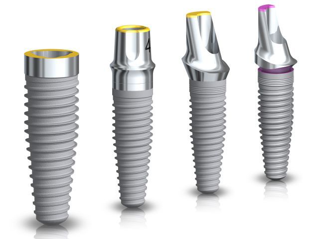 Health Management and Leadership Portal | Conical dental implant ...