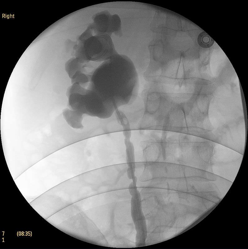 Health Management and Leadership Portal | Mobile C-arm / with flat ...