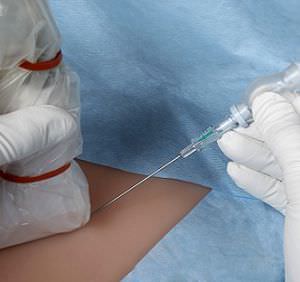 Health Management and Leadership Portal | Single-lumen implantable port ...