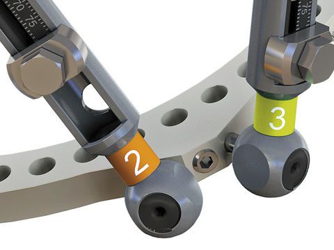 Health Management and Leadership Portal | Human external fixation ...