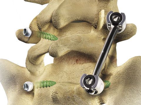 Health Management and Leadership Portal | Human external fixation ...