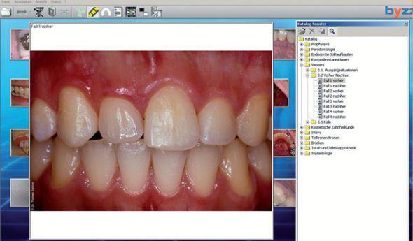 Health Management and Leadership Portal | Dental radiography flat panel ...