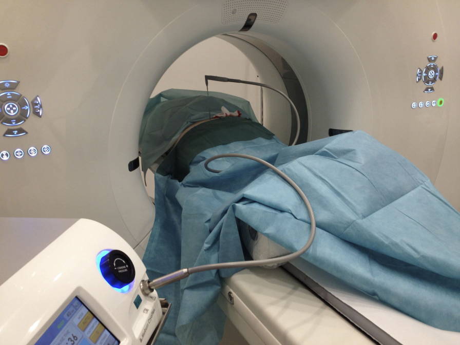 Health Management and Leadership Portal | Cryotherapy unit ...