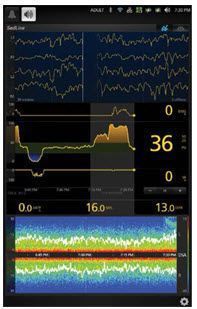 Health Management and Leadership Portal | EEG patient monitor ...