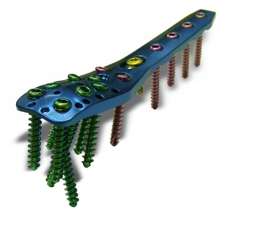 Health Management and Leadership Portal | Radius compression bone plate ...