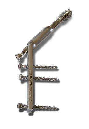 Health Management and Leadership Portal | Femoral head compression bone ...