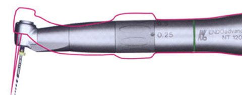 Health Management and Leadership Portal | Periodontal ultrasonic insert SONICflex rootplaner ...