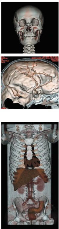 Health Management and Leadership Portal | CT scan test phantom / thorax ...