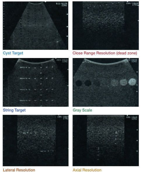 Health Management and Leadership Portal#N#| Ultrasound imaging test ...