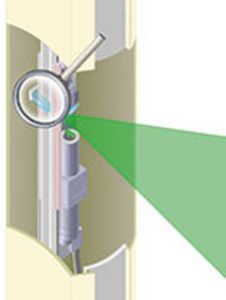 Health Management and Leadership Portal | Radiosurgery patient ...