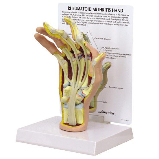 Health Management and Leadership Portal | Hand pathology anatomical ...