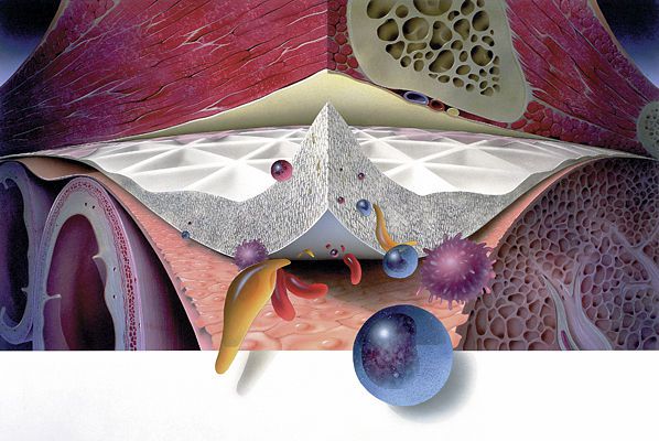 Health Management and Leadership Portal | Tunneling device vascular ...
