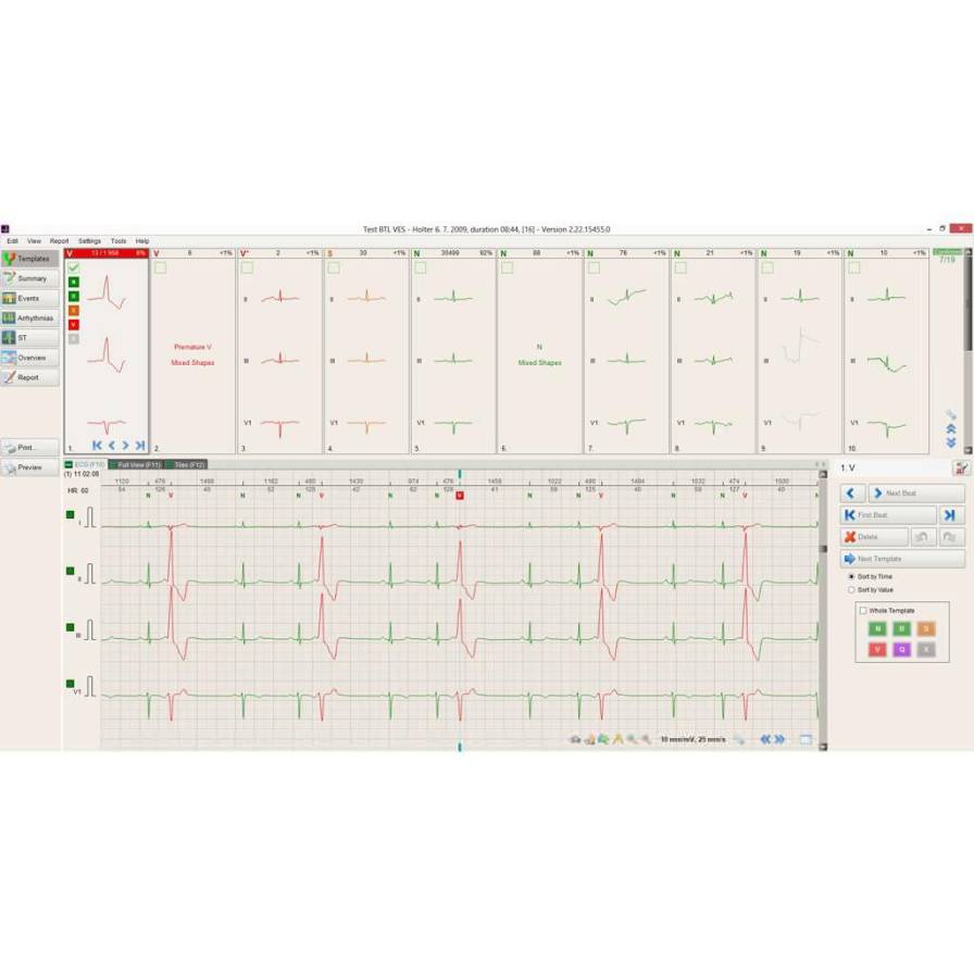 Health Management and Leadership Portal | 3-channels cardiac Holter ...