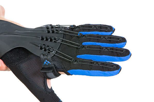 Health Management and Leadership Portal | Palmar resting splint ...