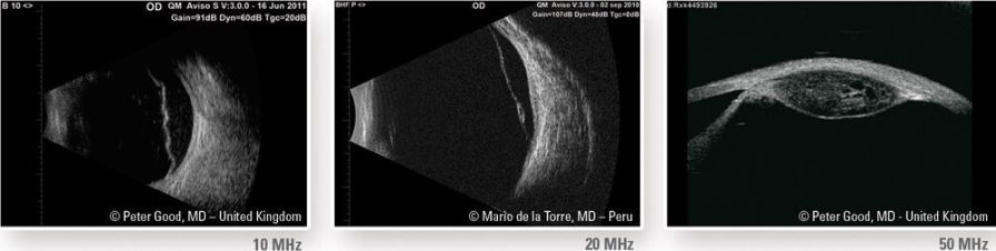Health Management and Leadership Portal | Pachymeter (ophthalmic ...