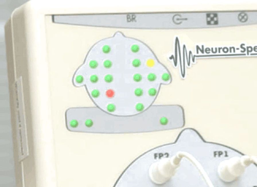 Health Management and Leadership Portal | 8-channel EEG system Neuron ...