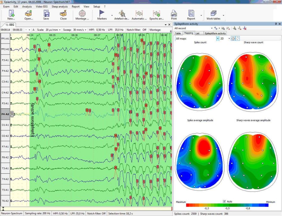 Health Management and Leadership Portal | EEG monitoring system Neuron ... Health Management and Leadership Portal | EEG monitoring system Neuron ...