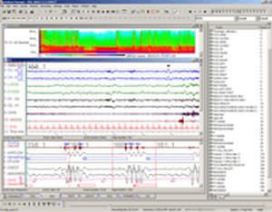 Health Management and Leadership Portal | Radiometer phototherapy ...