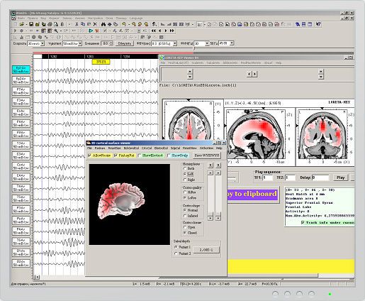 Health Management and Leadership Portal | Acquisition software / calibration / medical / EEG ...