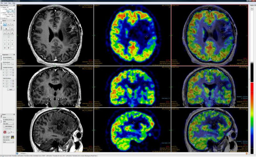 Health Management and Leadership Portal | SPECT Gamma camera ...
