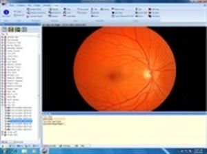 Health Management and Leadership Portal | Ophthalmic test chart monitor ...