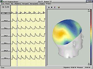 Health Management and Leadership Portal | Photoplethysmograph with ...