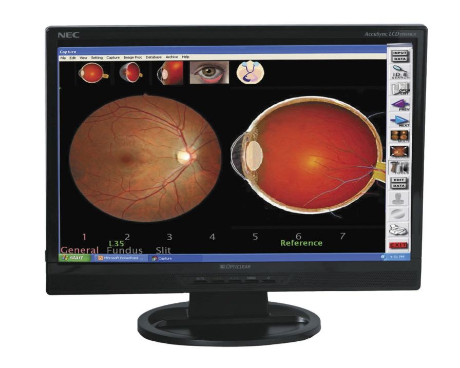 Health Management and Leadership Portal | Mydriatic retinal camera ...